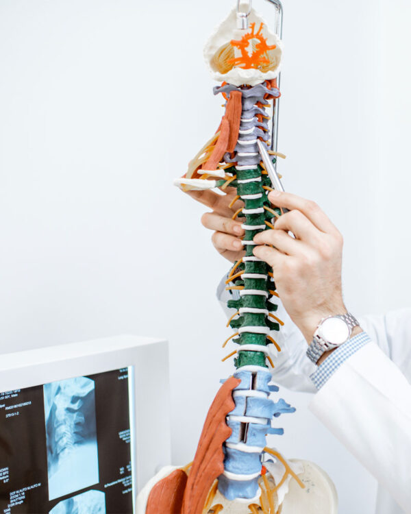 Scoliosis & Crooked Spine Problems- Squires Chiropractic